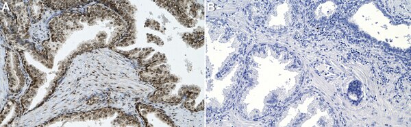 Anti-DNA Antibody, double stranded, clone AE-2 | MAB1293